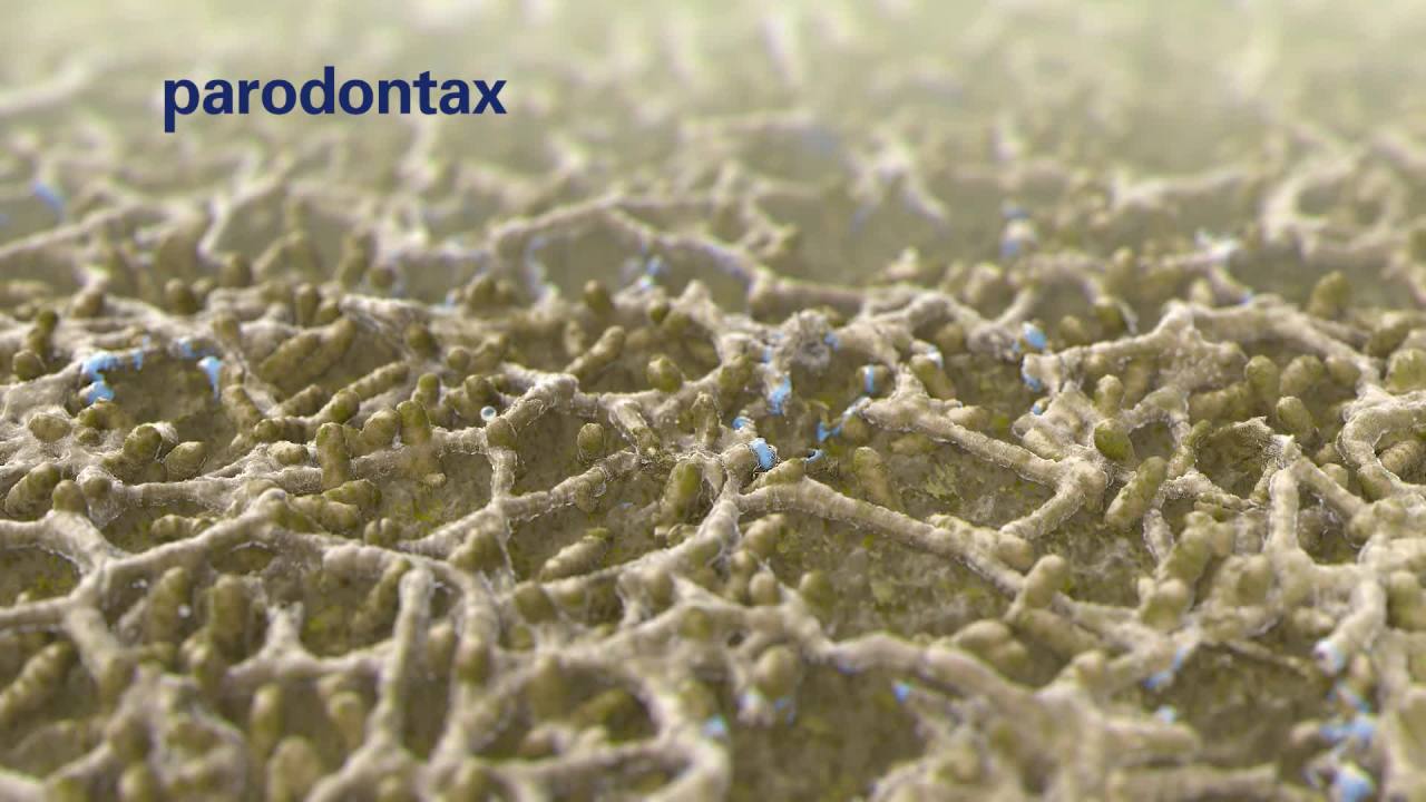 Parodontax Extra Fresh Toothpaste, 3.4 Oz - Anti-Gingivitis, Bleeding ...